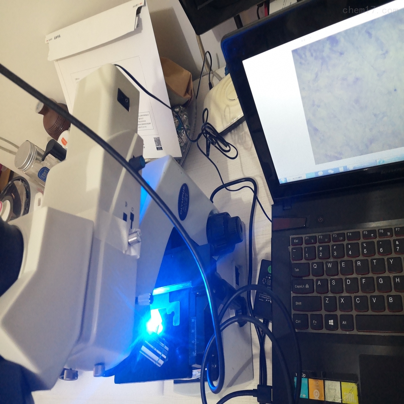 皮肤真菌-荧光显微镜CX23FL_CX23-北京荣兴光恒科技有限公司